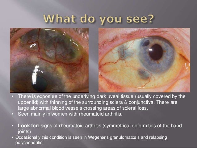 Common Cases: Lids, Conjunctiva and Sclera