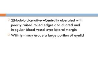 lid tumors including BCC,SCC,sebaceous carcinoma,malignant melanoma etc ...