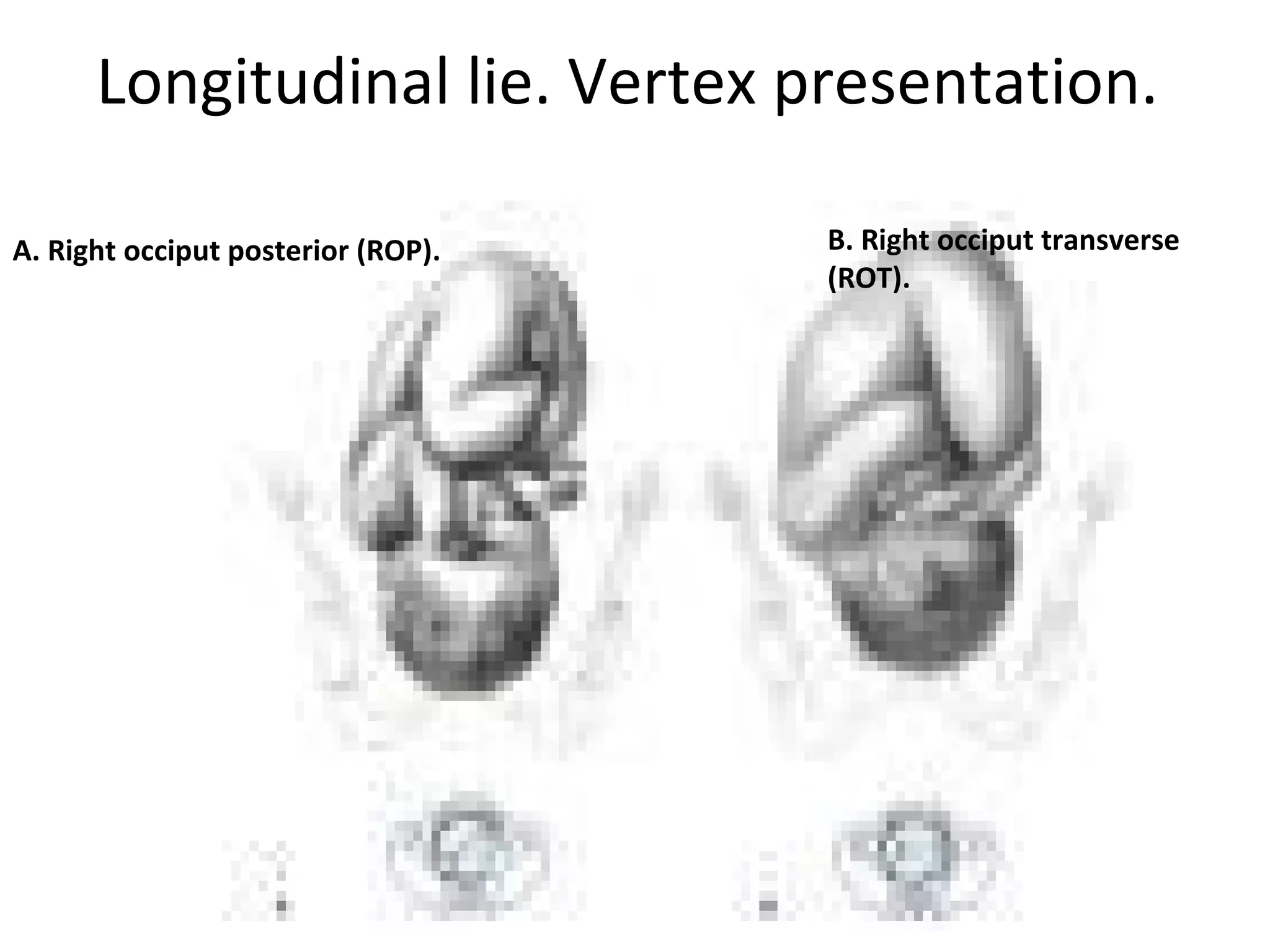 Lie, presentation, attitude, and position | PPT