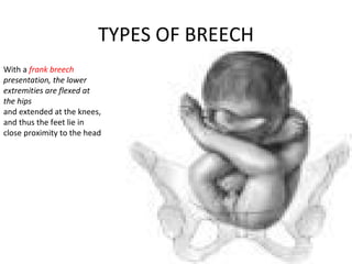 Lie, presentation, attitude, and position | PPT