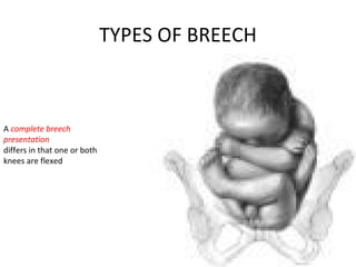 Lie, presentation, attitude, and position | PPT