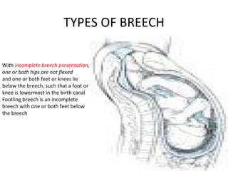 Lie, presentation, attitude, and position | PPT