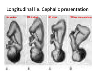 Lie, presentation, attitude, and position | PPT