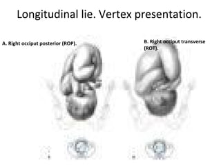 Lie, presentation, attitude, and position | PPT