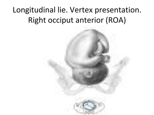 Lie, presentation, attitude, and position | PPT