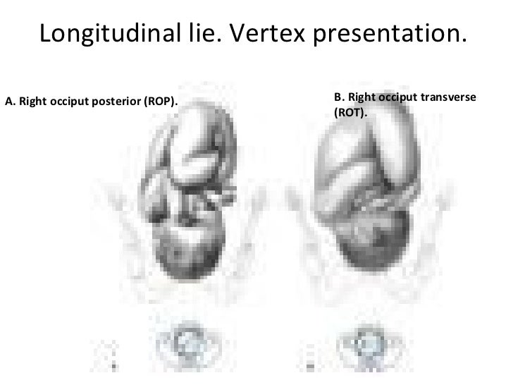 Lie, presentation, attitude, and position