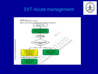 Life threatening arrhythmias in the ICU | PDF