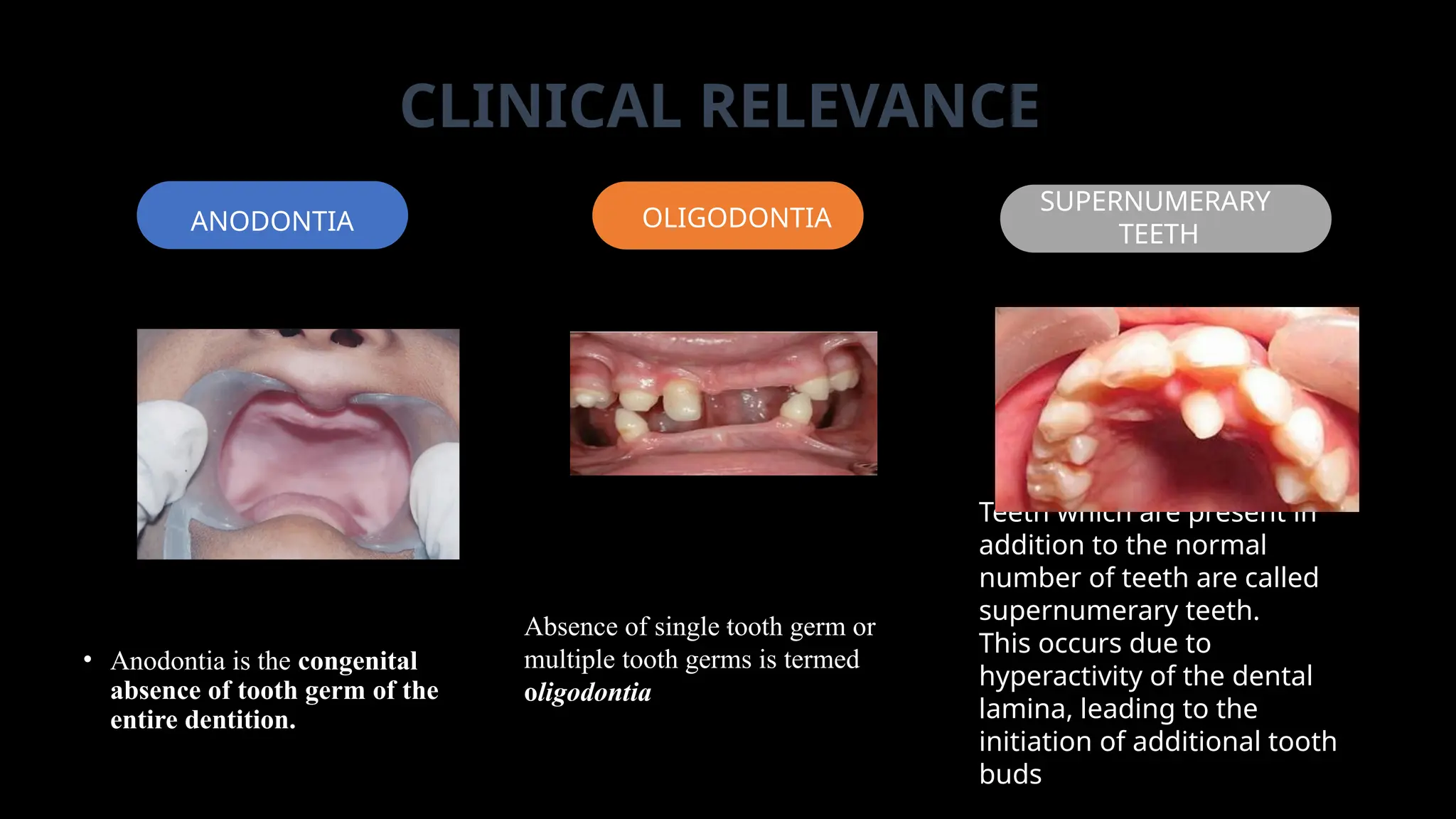 LIFE CYCLE OF TOOTH, ENAMEL AND DENTIN .pptx