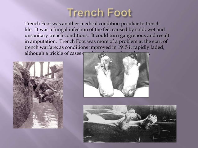 Life in the trenches | PPT