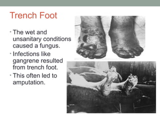 Life in the trenches | PPT