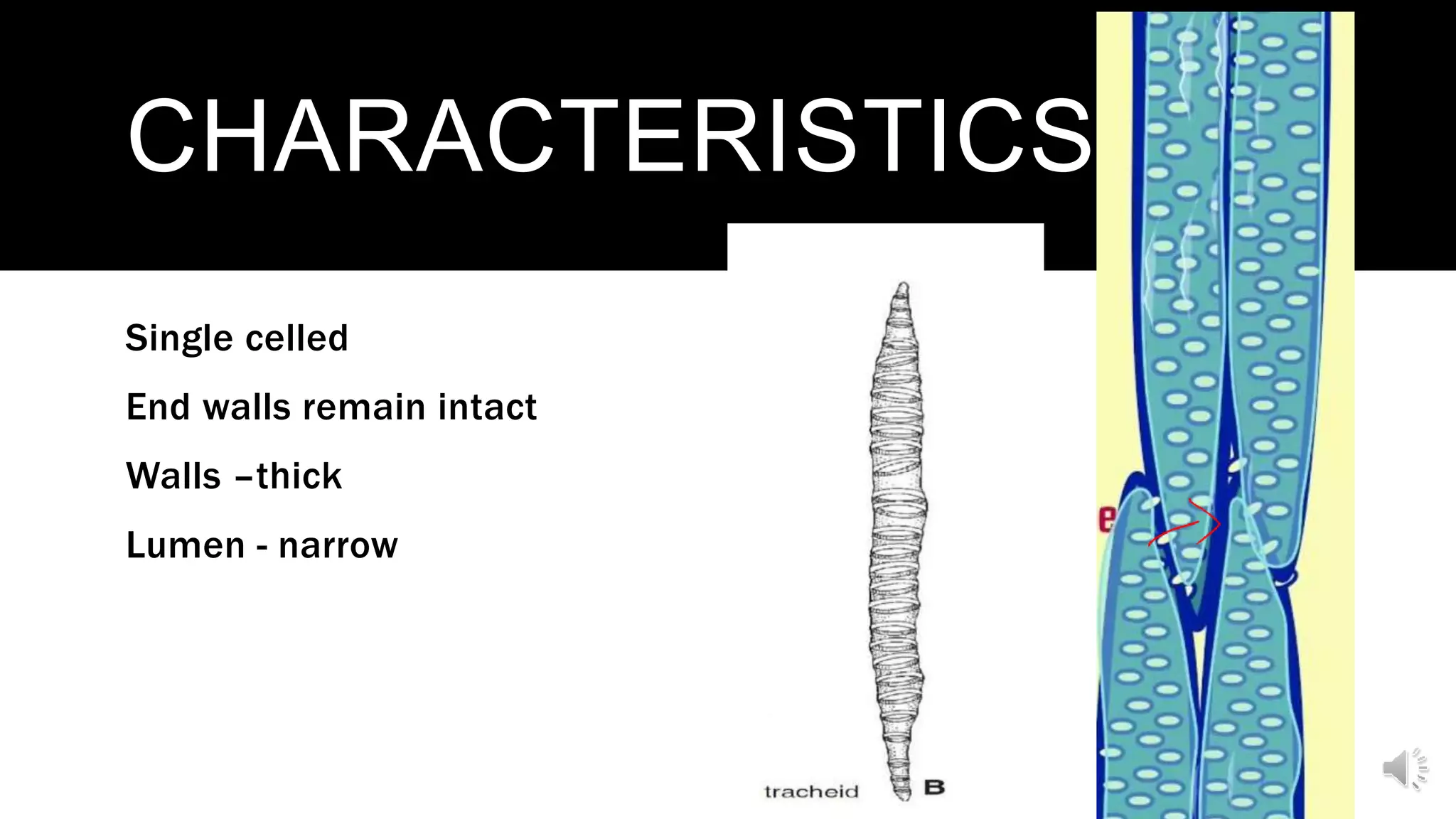 class 9th complex tissue xylem in detail | PPTX