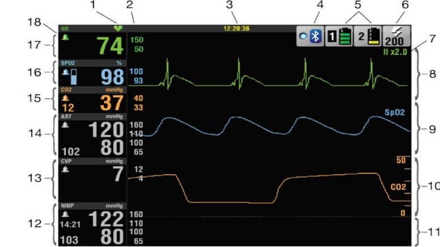 LIFEPAK 15 DEFIBRILLATOR and Monitorpptx | PPTX