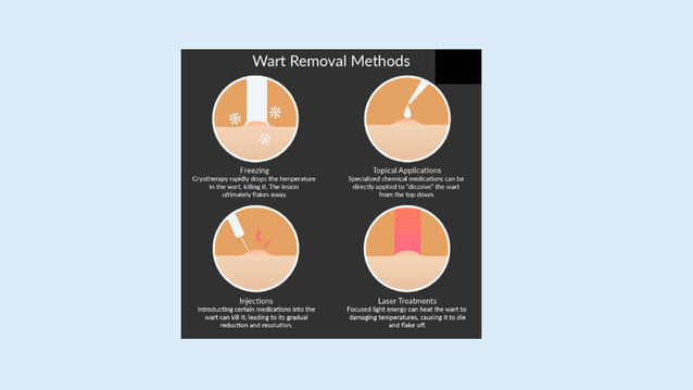 Lifero Moles and Warts Treatment Pune | PPT