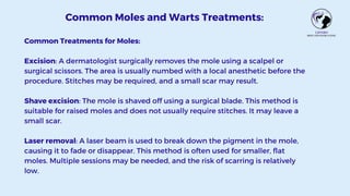 Lifero Moles and Warts Treatment Pune | PDF
