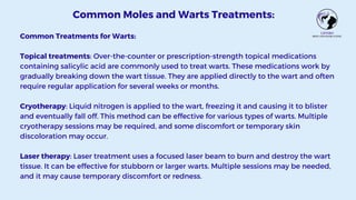 Lifero Moles and Warts Treatment Pune | PDF