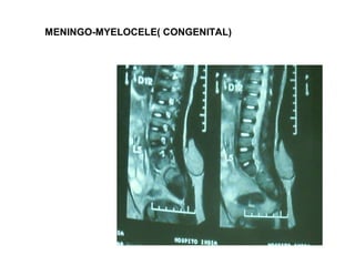 Life saving neurosurgery - | PPT