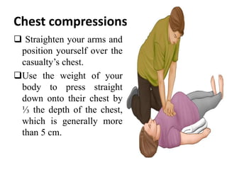 life saving skil.ppt during preganncy | PPT