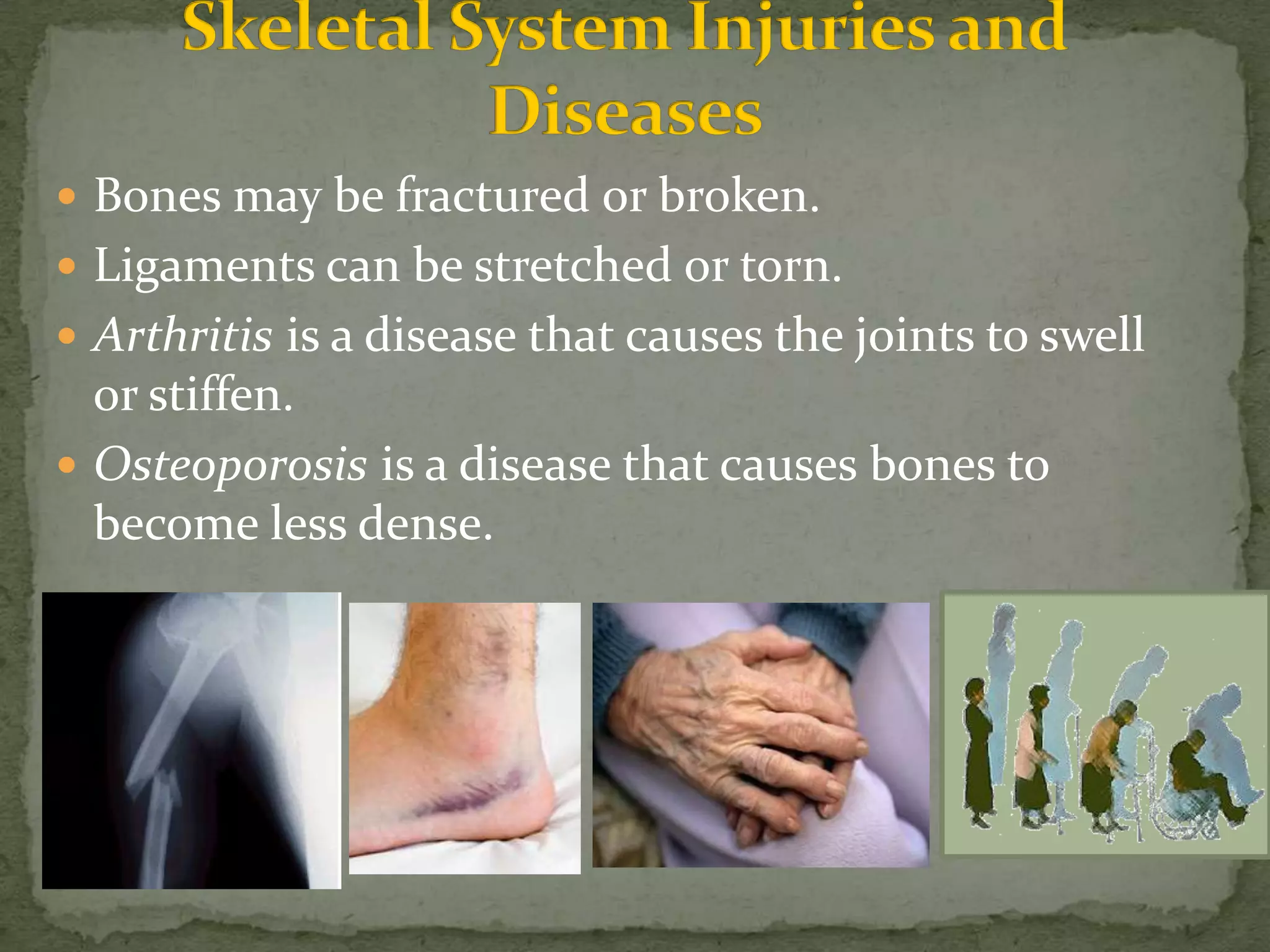 Life Science 1.2 : The Skeletal System | PPTX