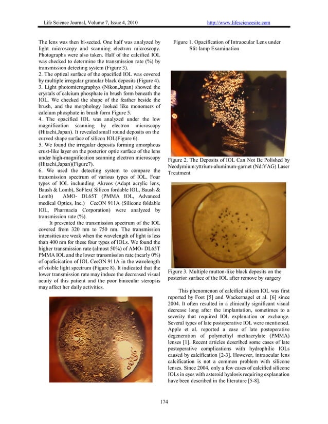 Life science journal | PDF | Eye and Vision Conditions | Diseases and ...