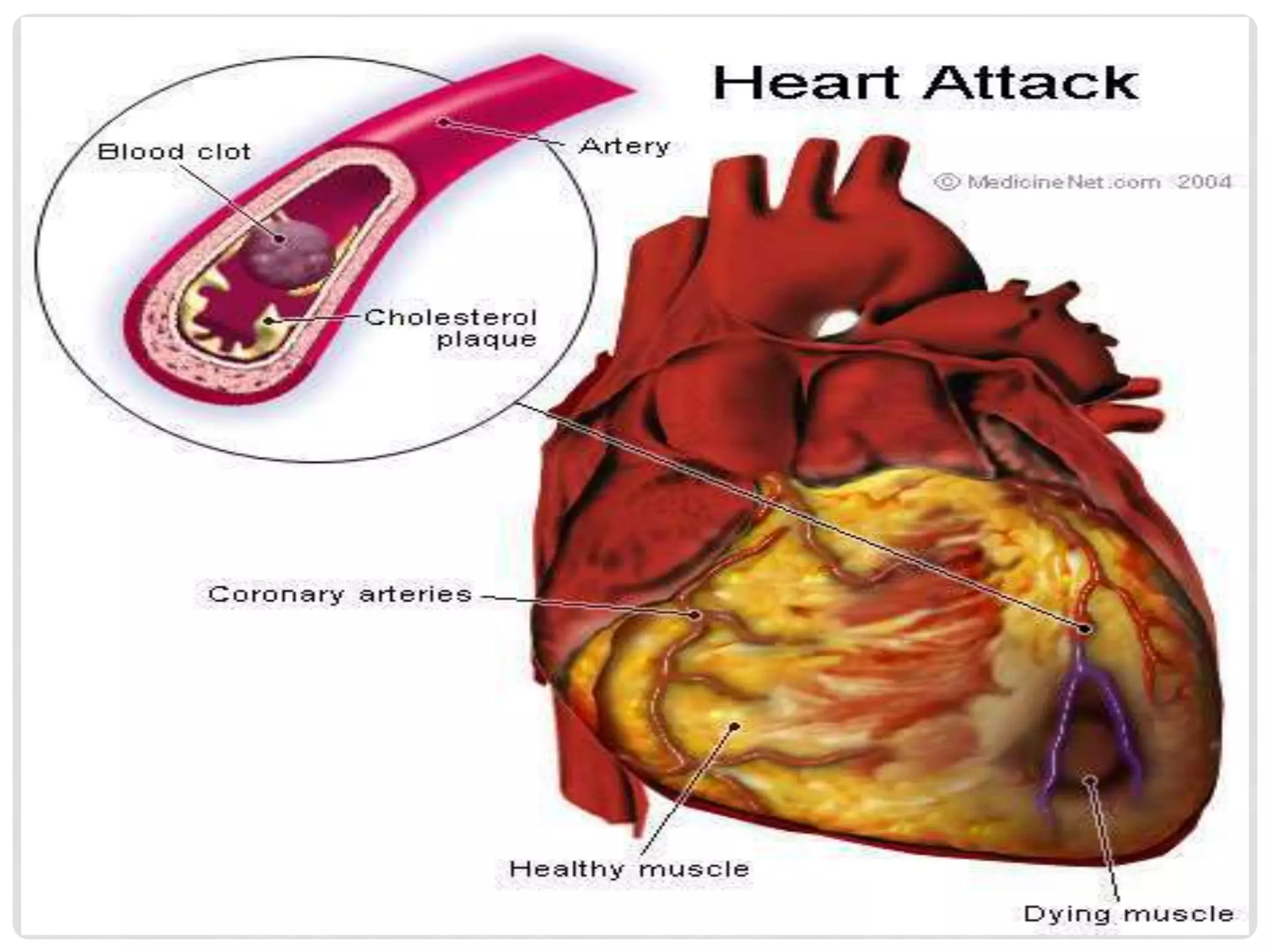 Lifestyle diseases and management | PPTX