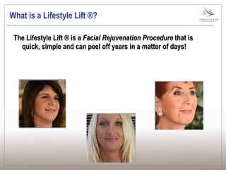 Lifestyle Lift Results | PPT