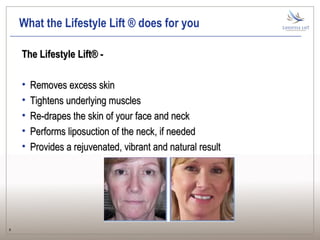 Lifestyle Lift Results | PPT