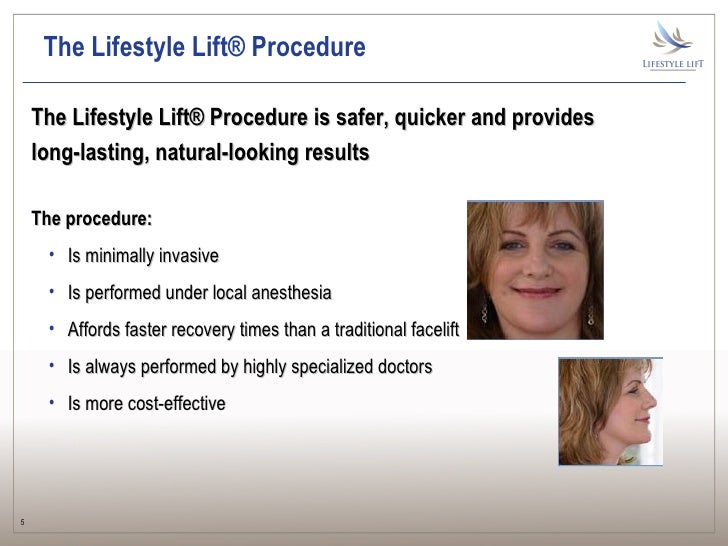 Lifestyle Lift Results