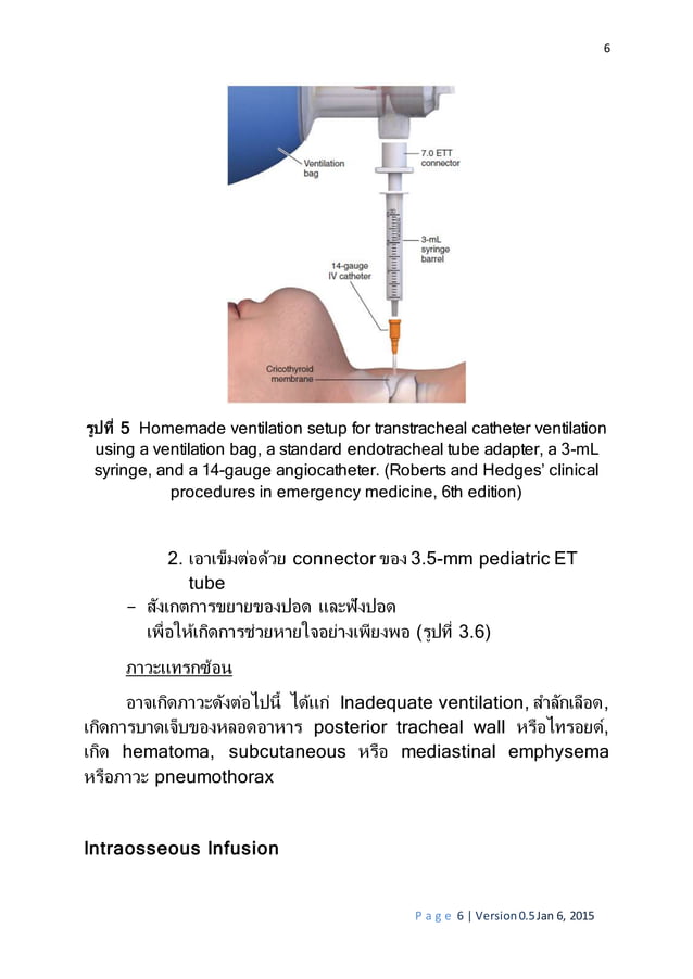 Life support procedures | PDF
