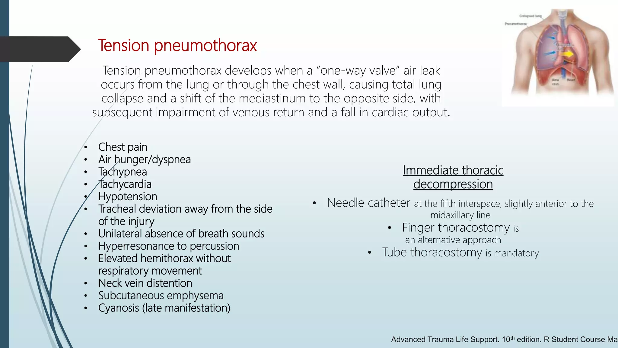 Life threatening chest trauma | PPTX | First Aid | Injuries