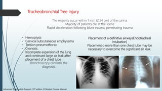 Life threatening chest trauma | PPTX | First Aid | Injuries