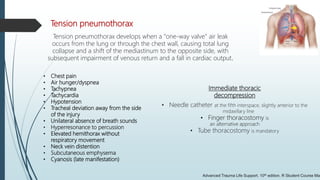 Life threatening chest trauma | PPTX