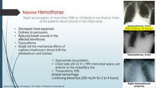 Life threatening chest trauma | PPTX | First Aid | Injuries
