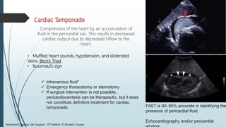 Life threatening chest trauma | PPTX