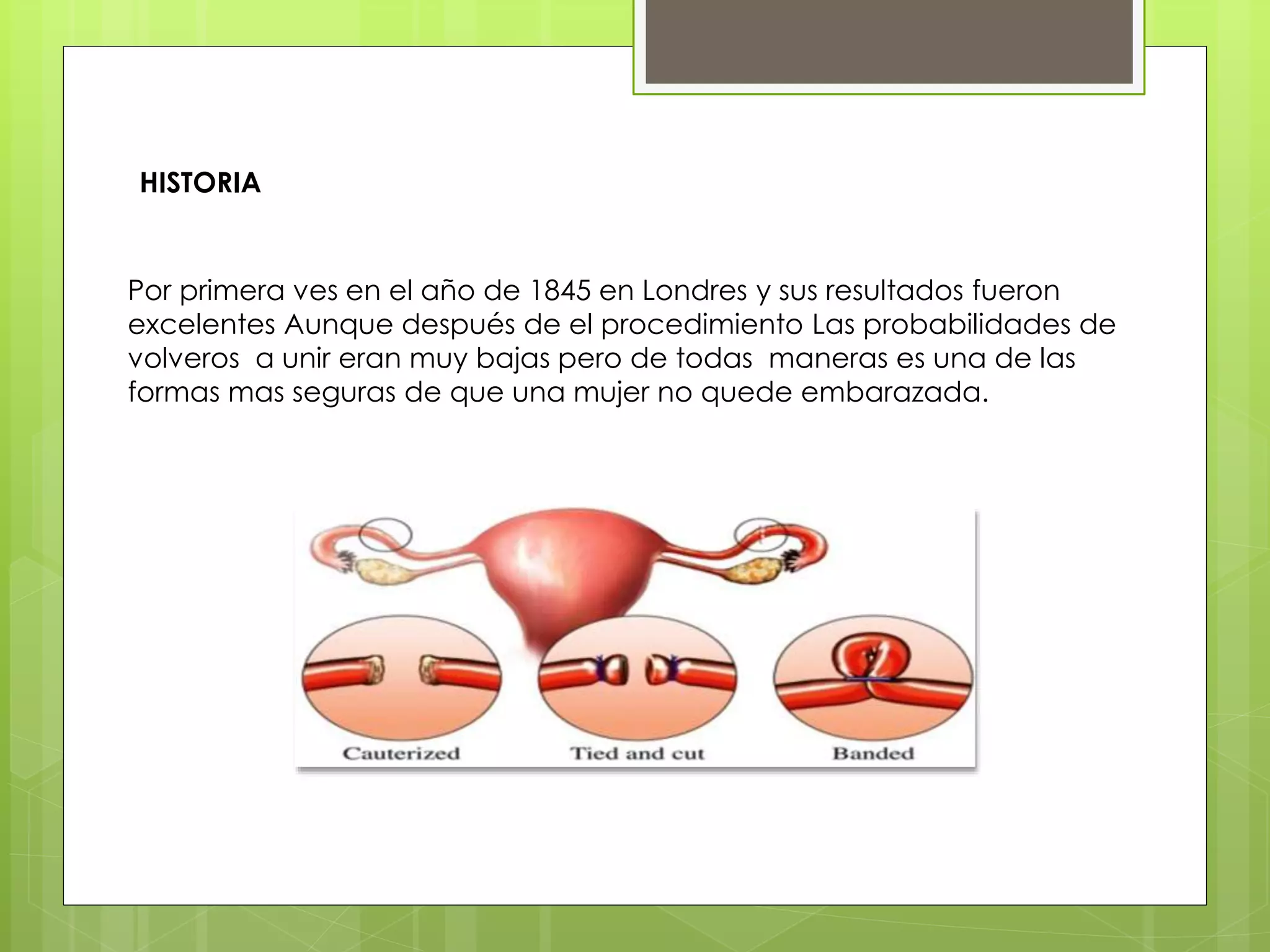 Ligadura de las trompas de falopio | PPTX | Pregnancy | Reproductive Health