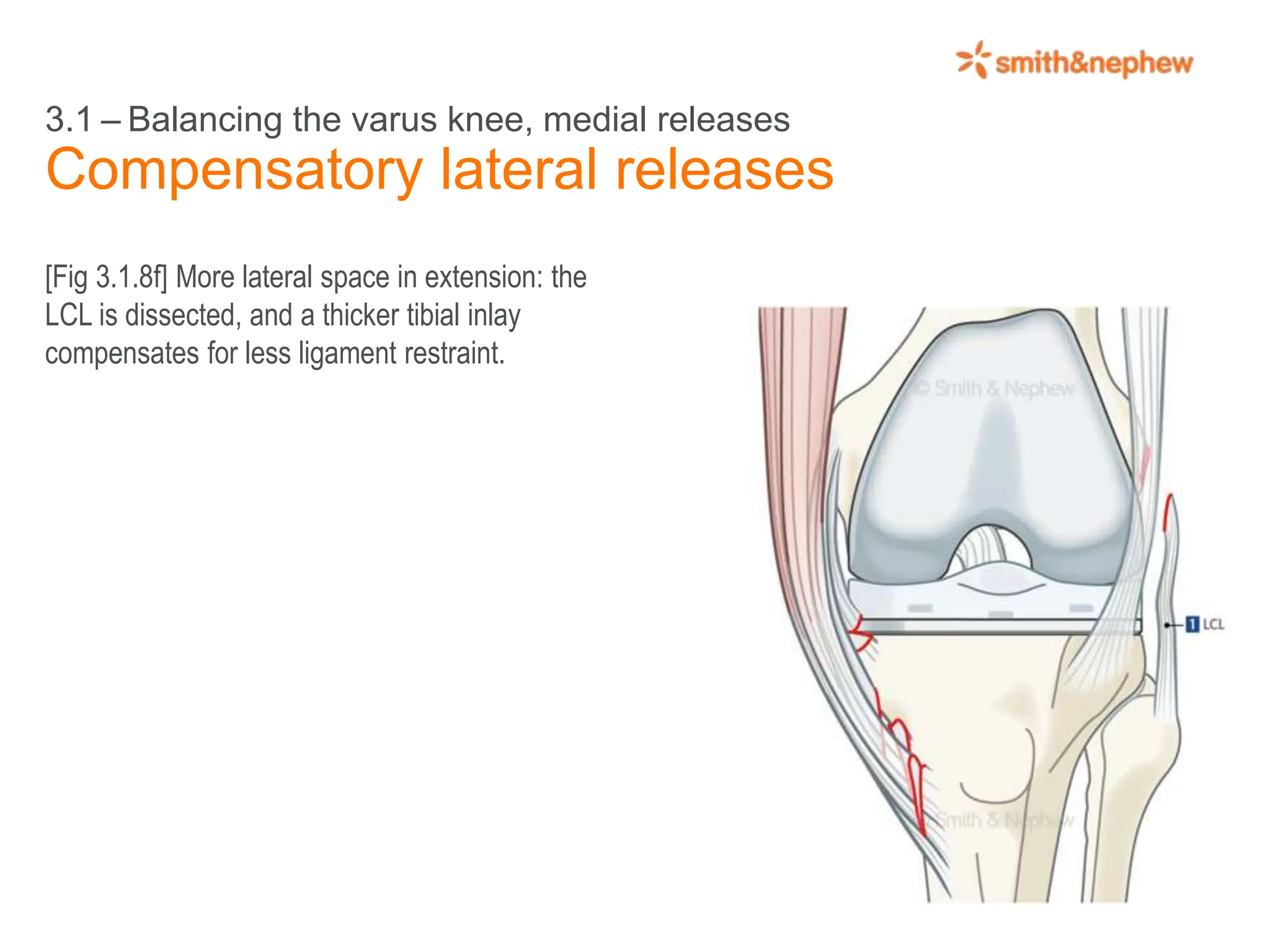 Ligamentaaaaaaaaaaaasaasaaaaaassssssssss | PPTX