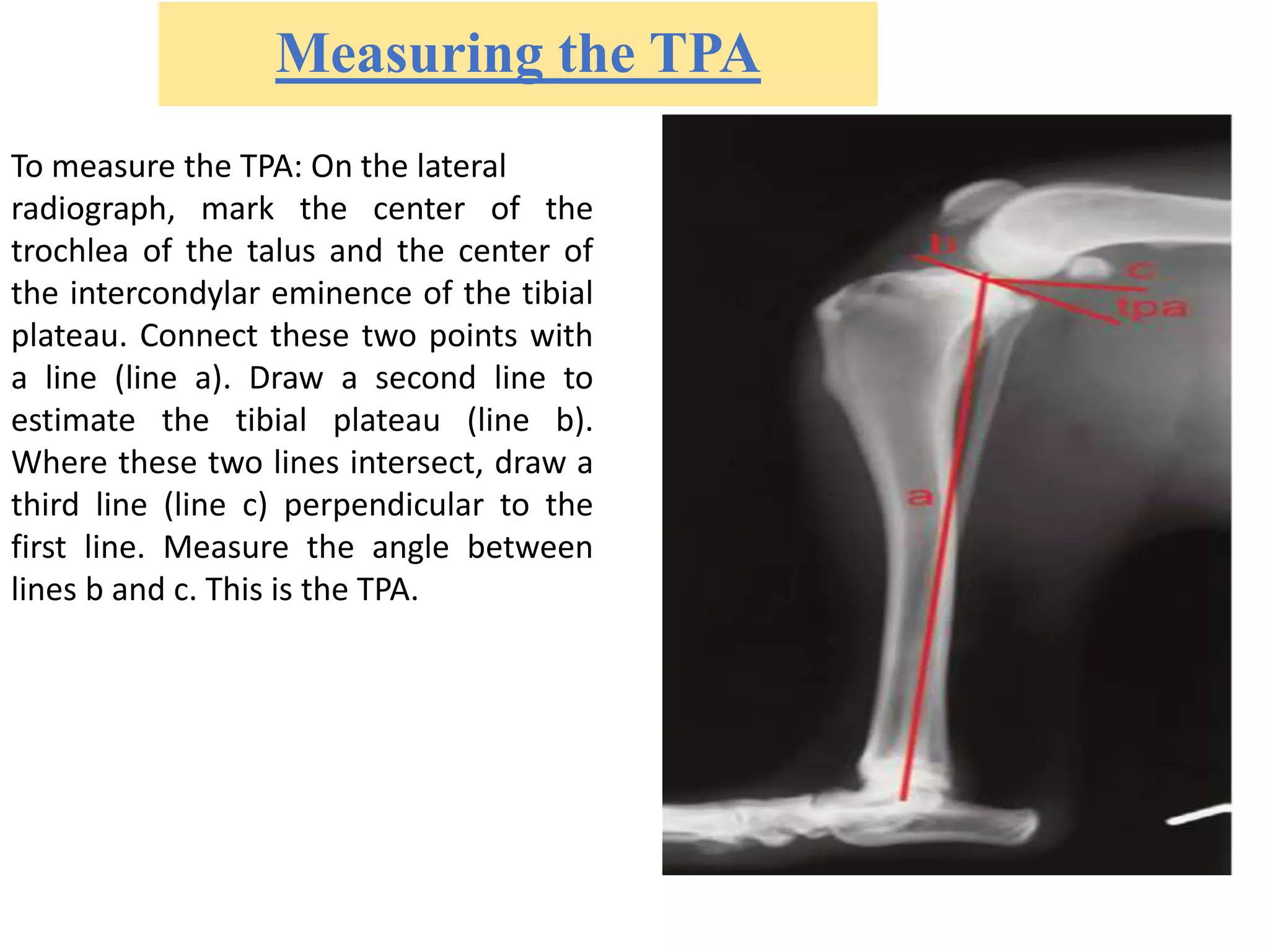 Ligament Injuries.pptx