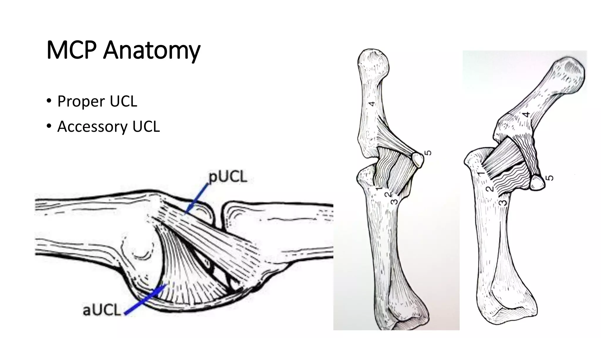 Ligament injuries of hand and wrist | PDF