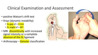 Ligament injuries of hand and wrist | PDF | Death, Injury, or Military ...