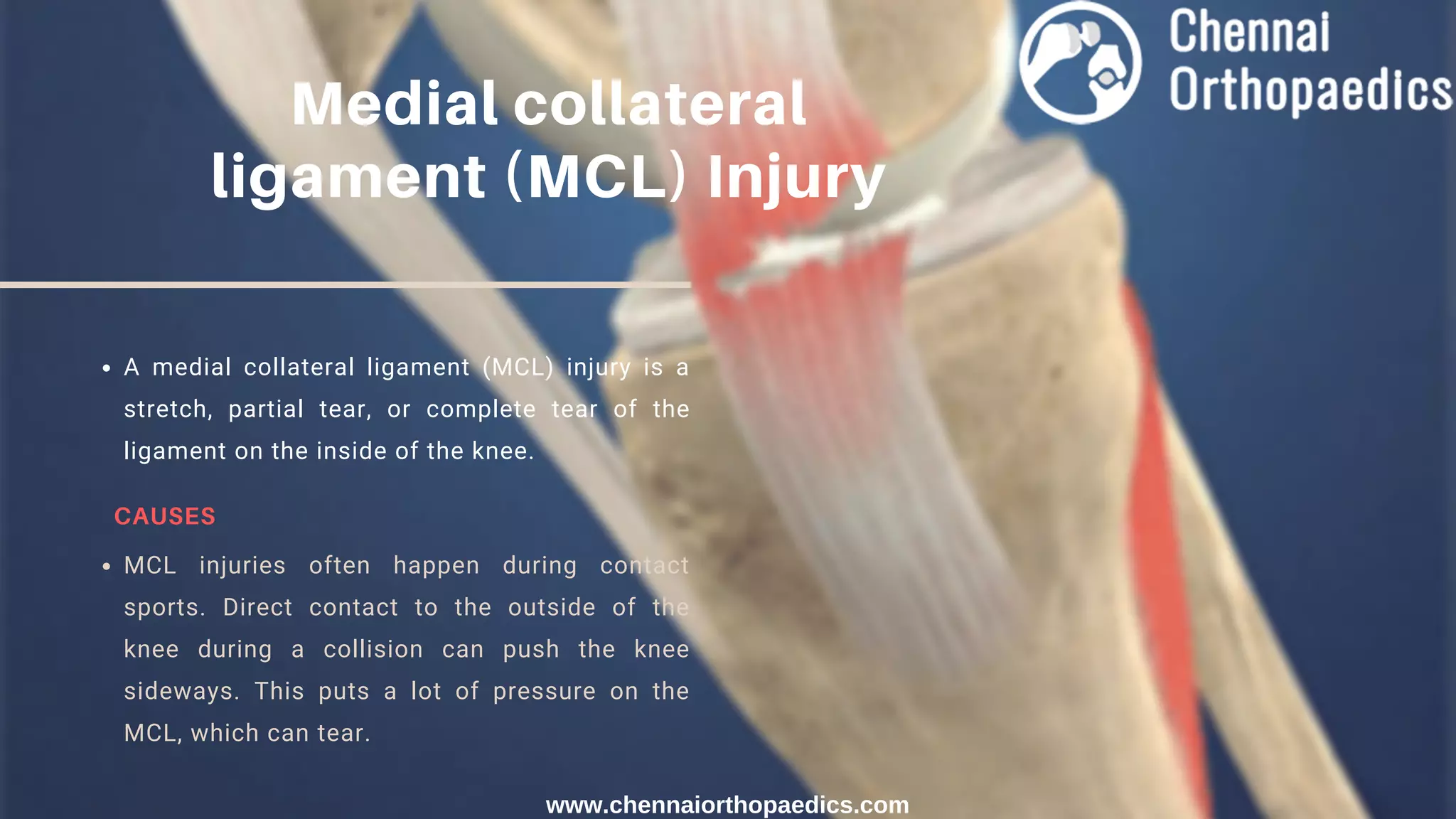 Ligament injuries of knee | PDF