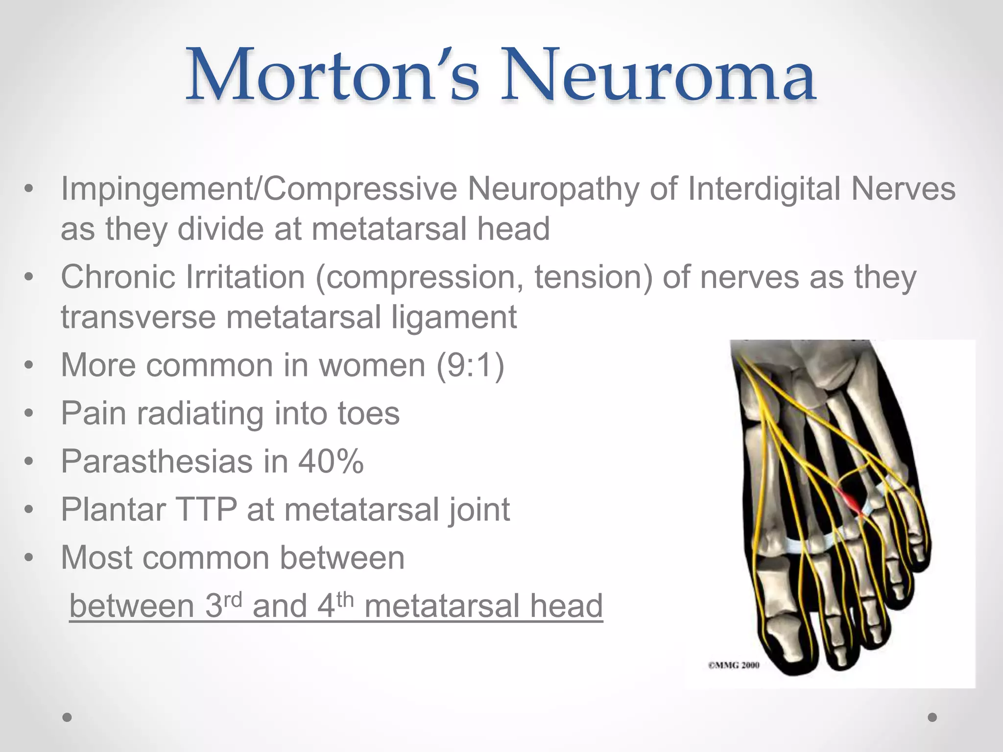 Ligament injury around ankle.pptx