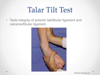Ligament injury around ankle.pptx