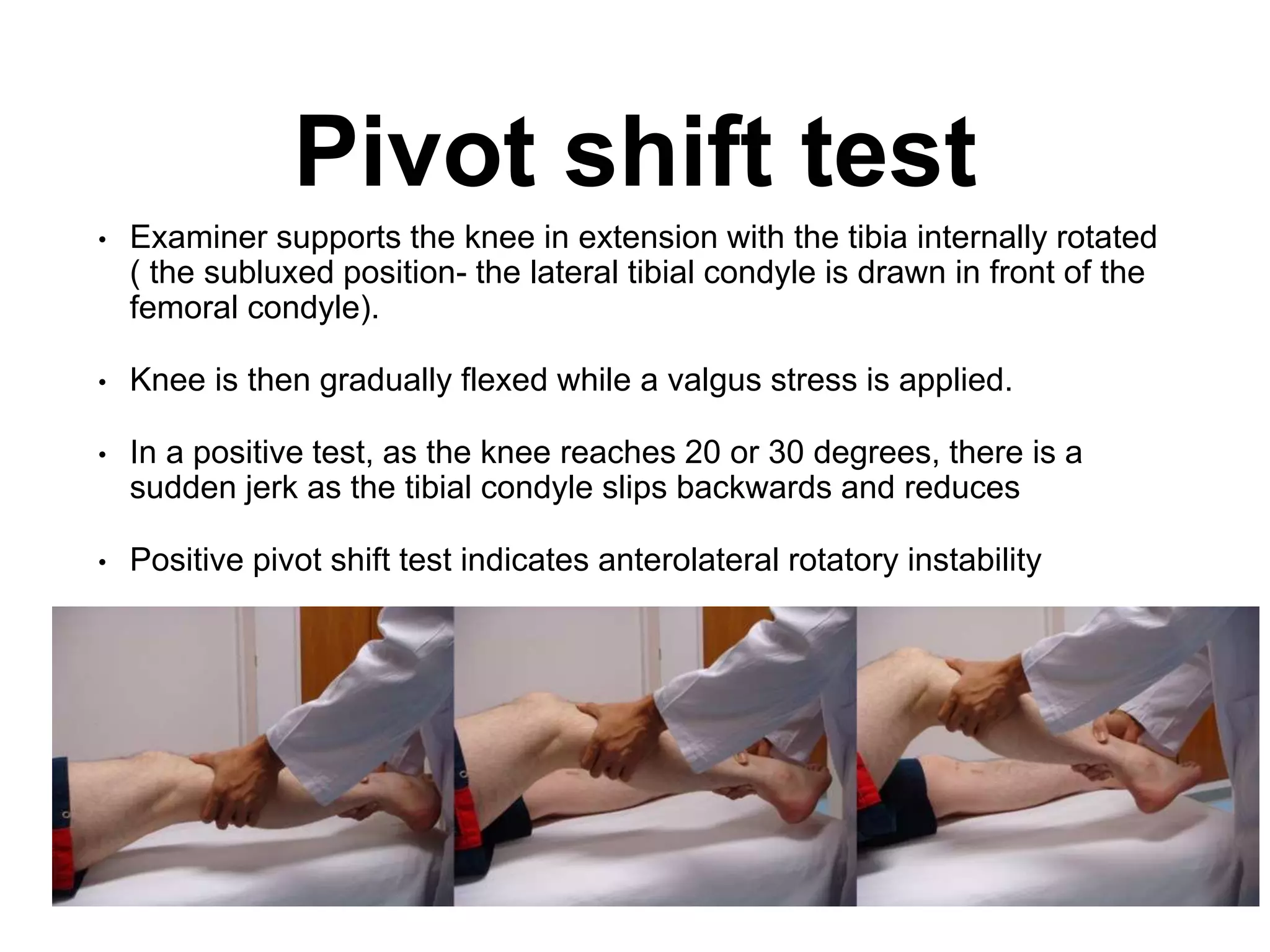 Ligament injury to knee: ACL | PPTX