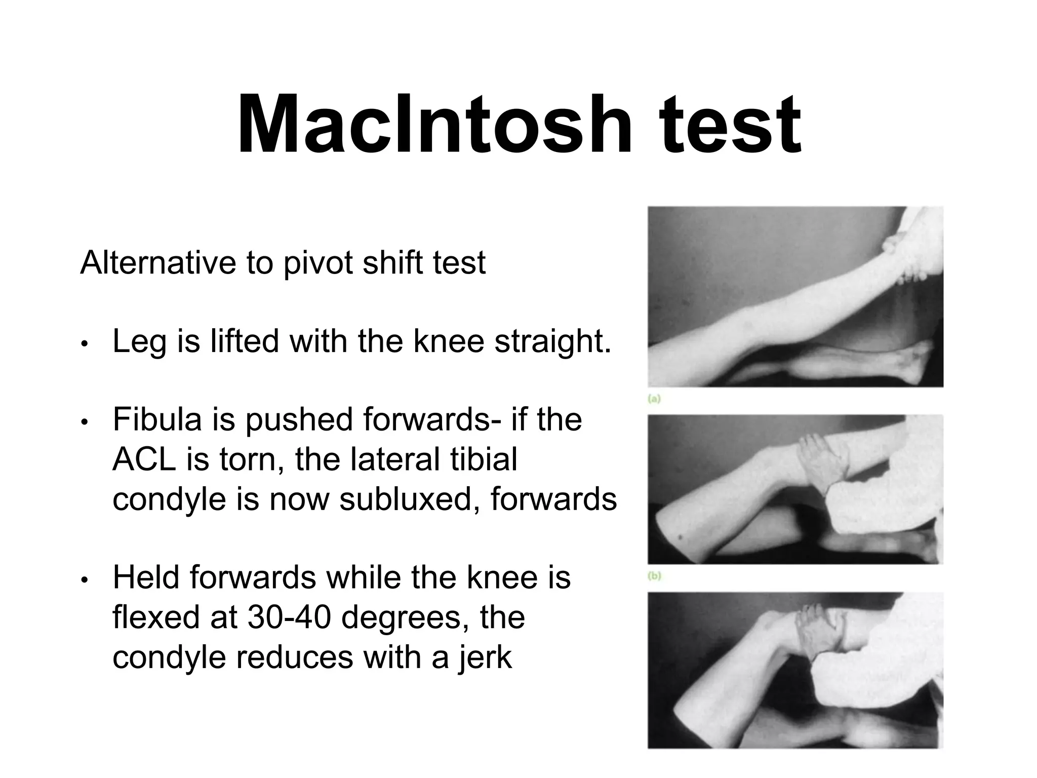 Ligament injury to knee: ACL | PPTX