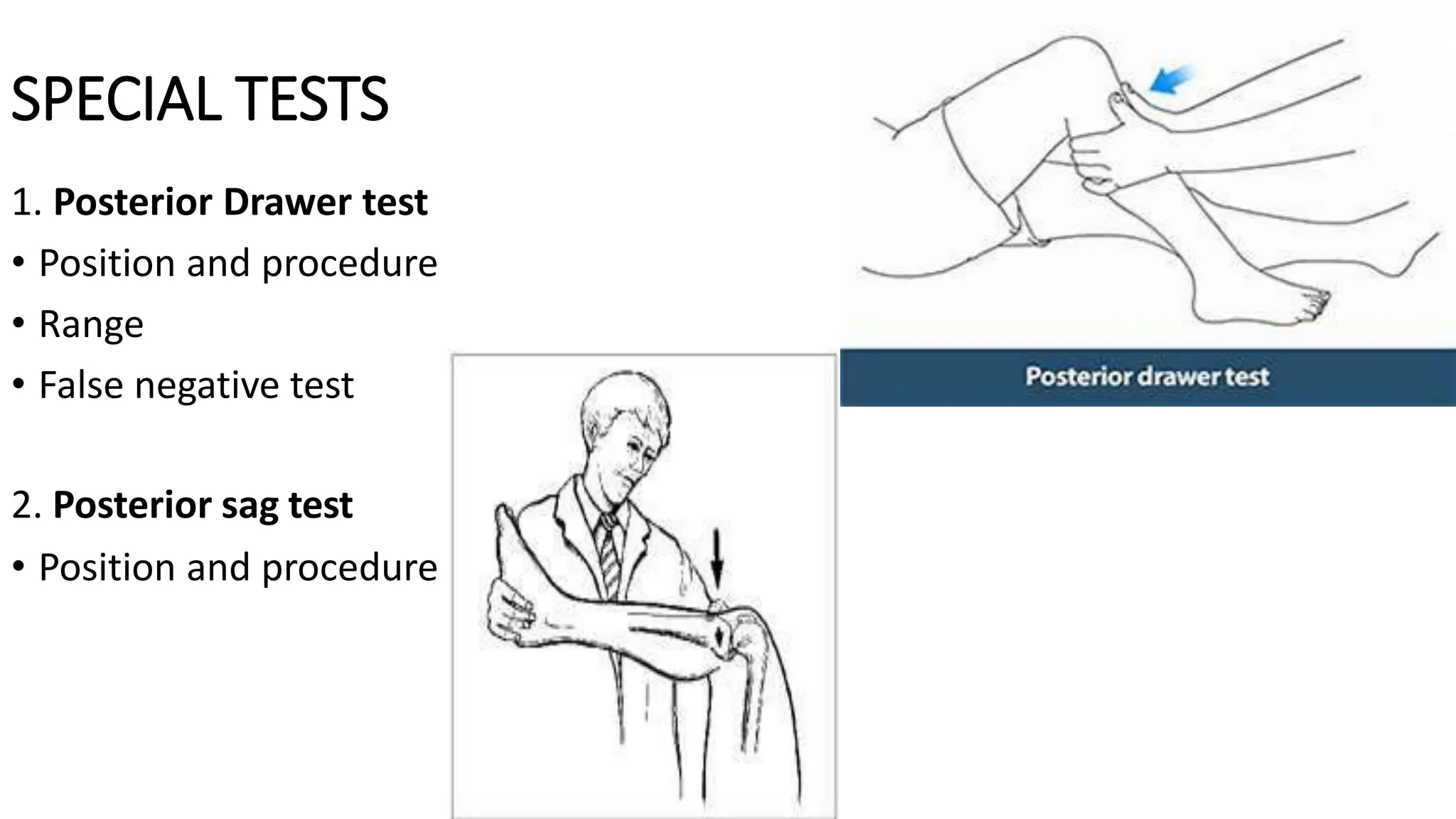 LIGAMENTS INJURIES AROUND KNEE.pptx