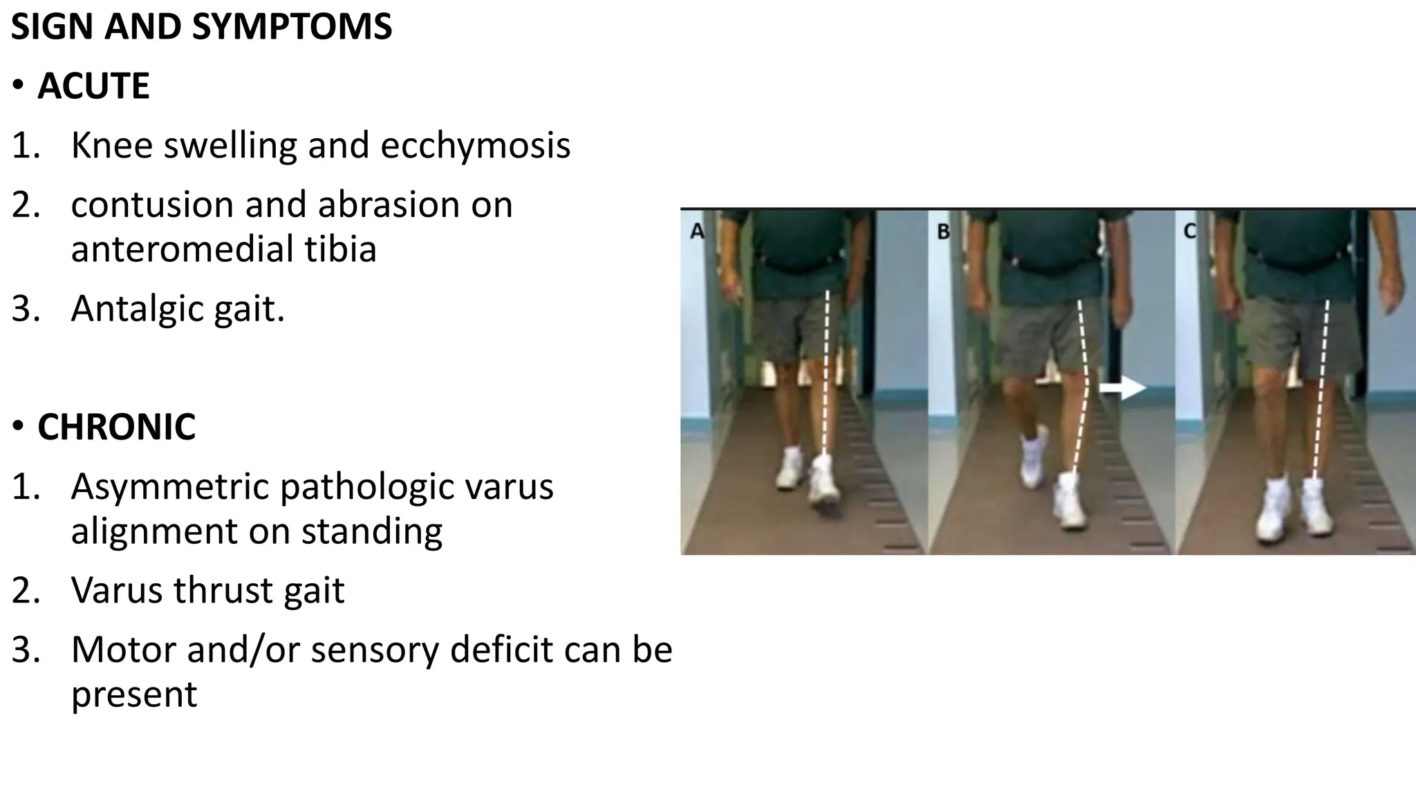 LIGAMENTS INJURIES AROUND KNEE.pptx