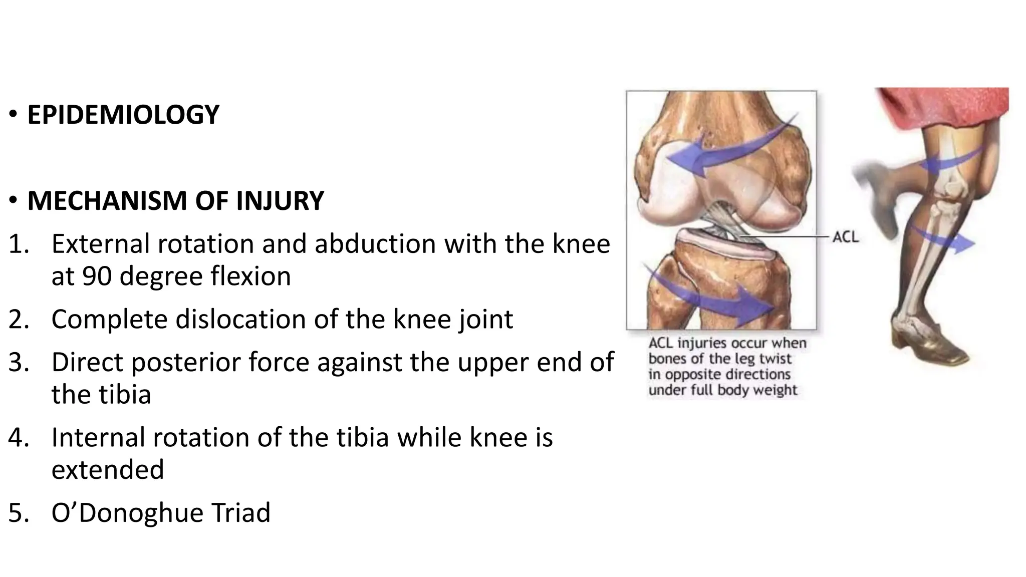 LIGAMENTS INJURIES AROUND KNEE.pptx