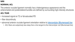 LIGAMENTS INJURIES AROUND KNEE.pptx