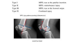 LIGAMENTS INJURIES AROUND KNEE.pptx