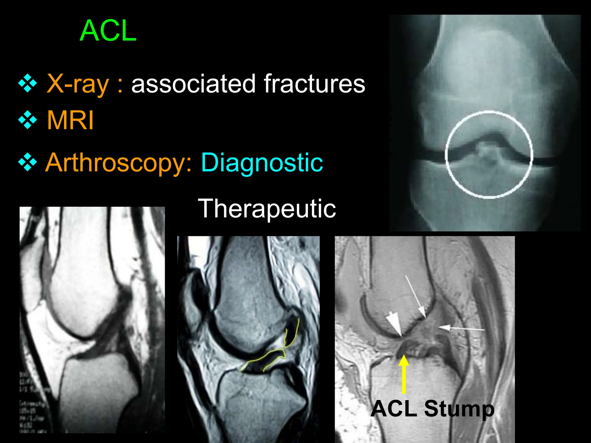 Slide for ligament injury, good for quick reference | PPT
