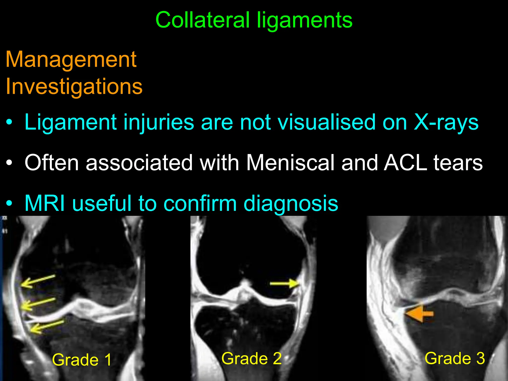 Slide for ligament injury, good for quick reference | PPT